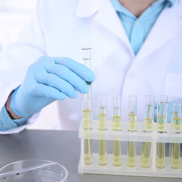 | Urineanalyse: samenstelling en gezondheidsindicatoren Dimann