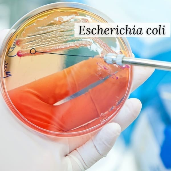 | Escherichia coli: alles wat je moet weten Dimann